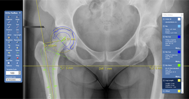 Tech Tuesday with SECTRA 31/10 - Science Park Mjärdevi